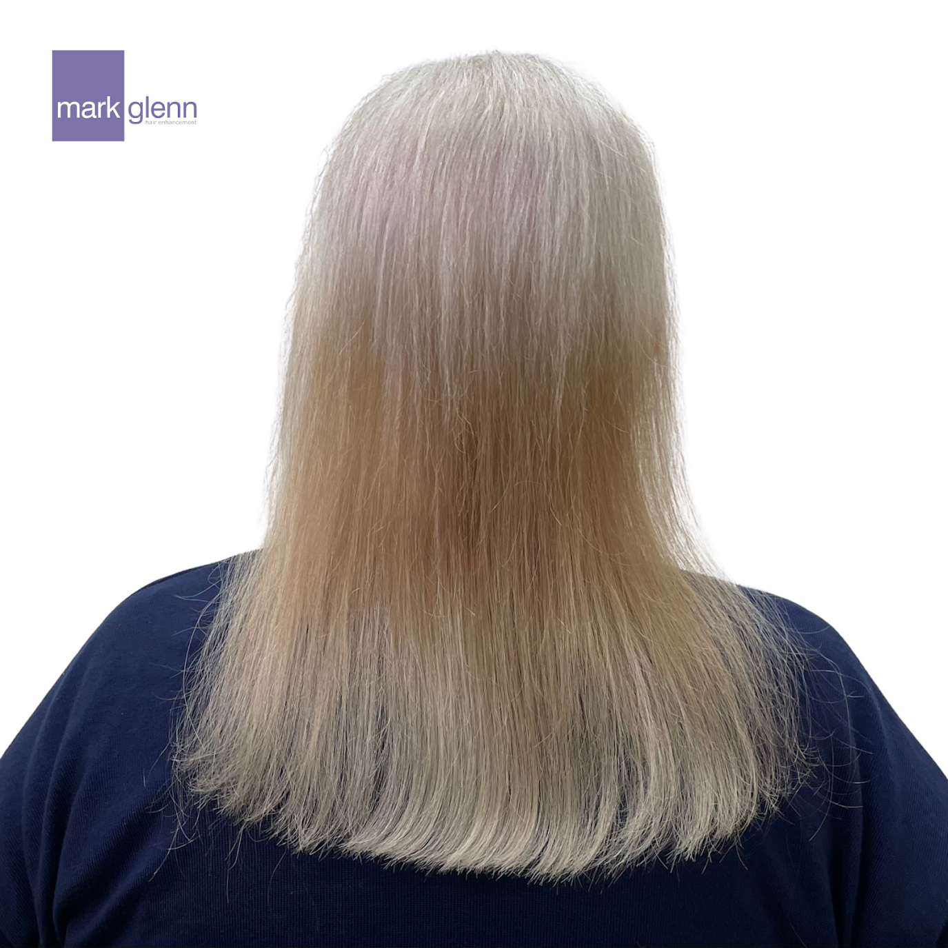 Hl115 Androgenetic Alopecia Or Female Pattern Hair Loss Solution