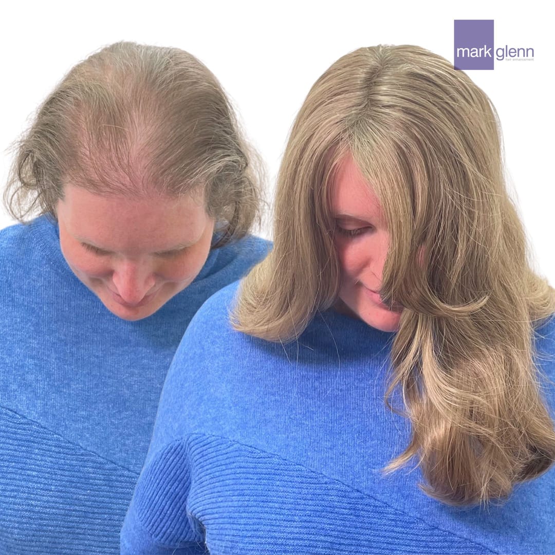Hair Extension & Female Hair Loss Before & After Gallery | Mark Glenn ...